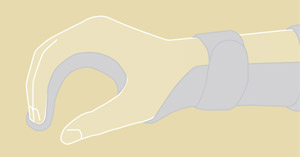 Hand Therapy: What Is Right for Me? | The Hand Society