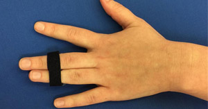 Jammed Finger: Symptoms and Treatment | The Hand Society