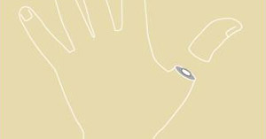 Arm, Hand and Finger Replantation | The Hand Society