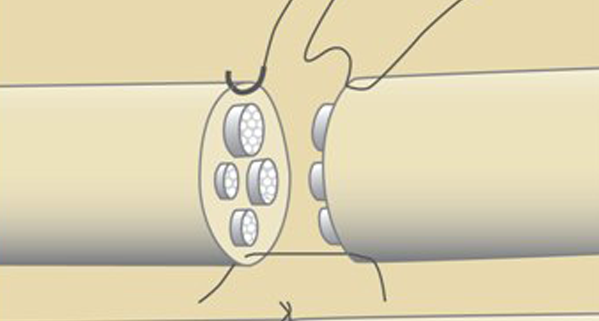Nerve Damage and Repair | The Hand Society