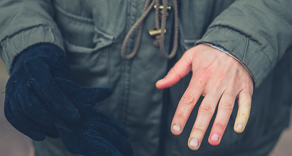 What Is Raynaud's Disease? | The Hand Society